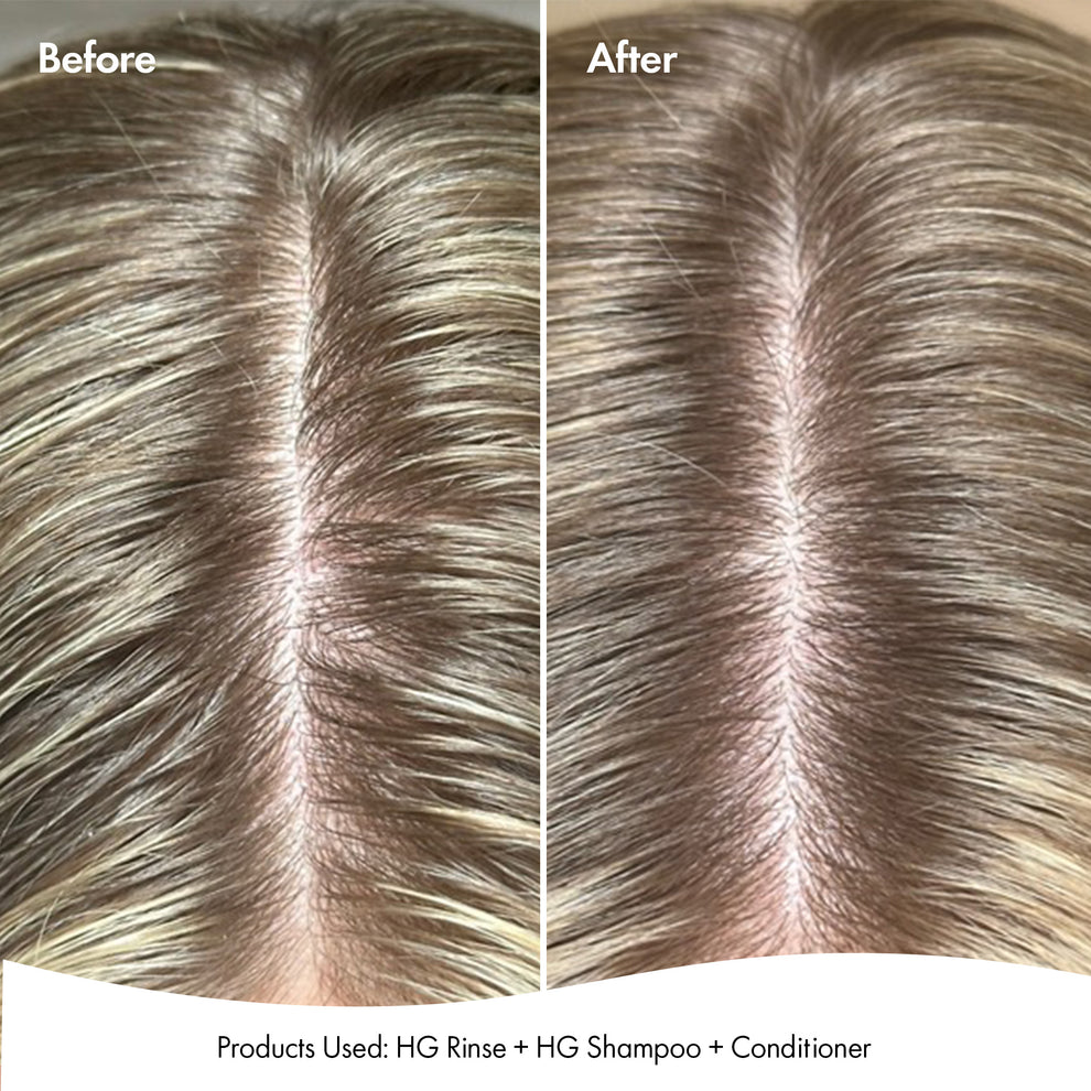 CLARIFYING SCALP & HAIR RINSE – BondiBoost.com