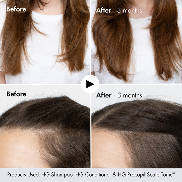 HG Shampoo - Improves appearance of thinning hair – BondiBoost.com