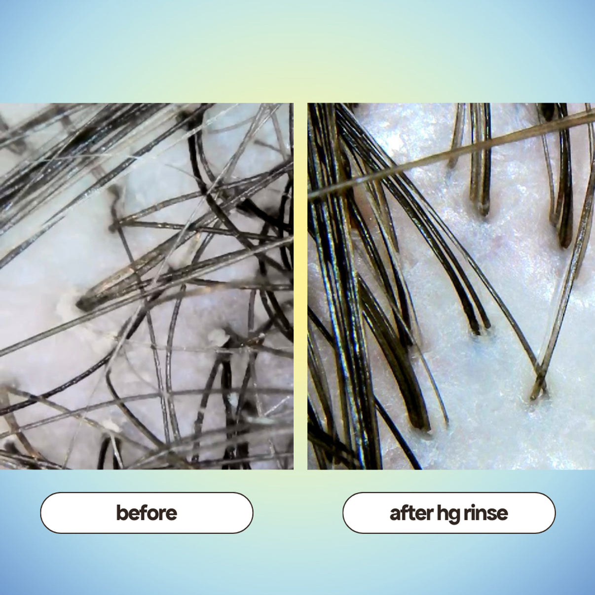 CLARIFYING SCALP & HAIR RINSE – BondiBoost.com